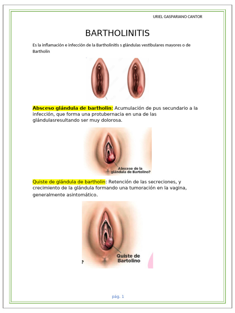 BARTHOLINITIS | PDF