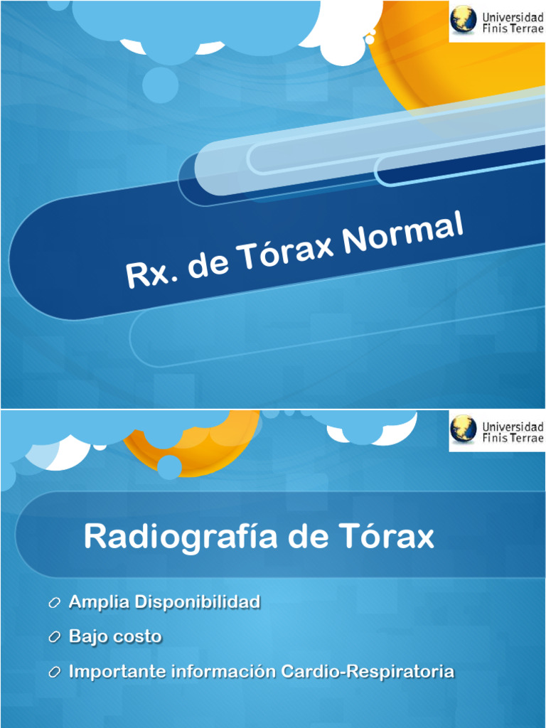 RX Torax Normal | PDF