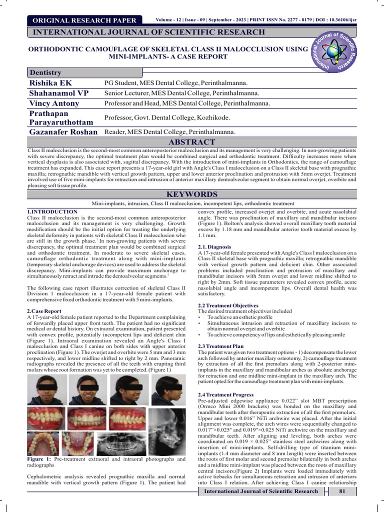 Orthodontic Camouflage of Skeletal Class II Malocclusion Using ...
