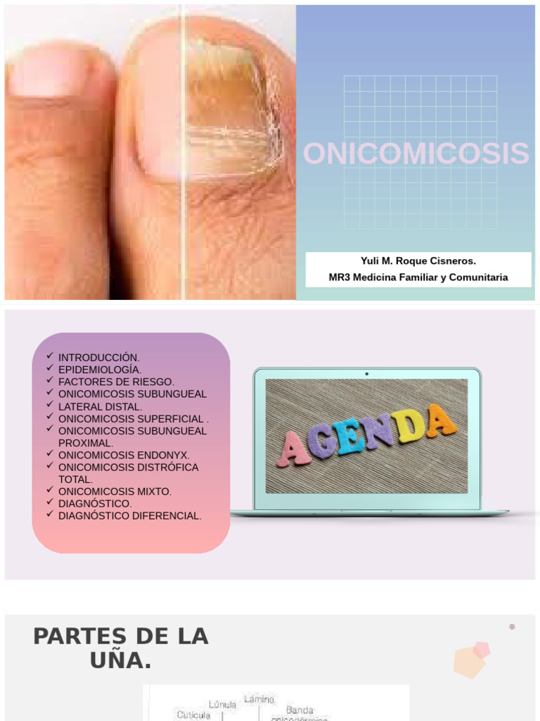 ONICOMICOSIS | PDF