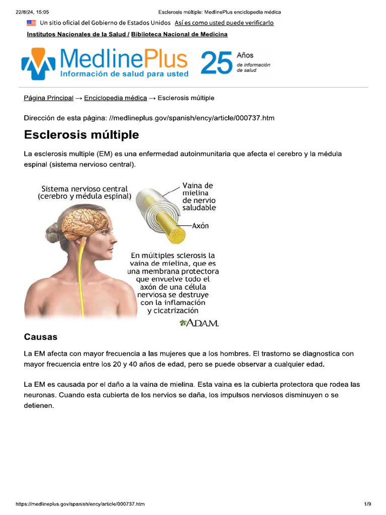 Esclerosis Multiple | PDF
