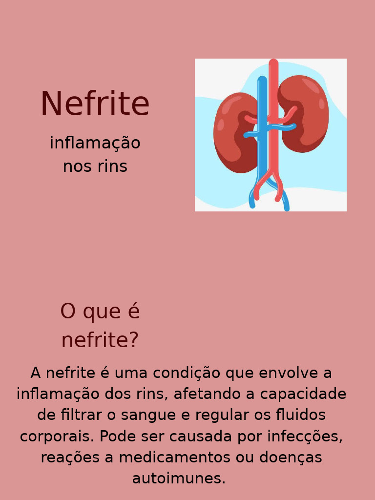 Caso Clin Nefrite Lupica | PDF