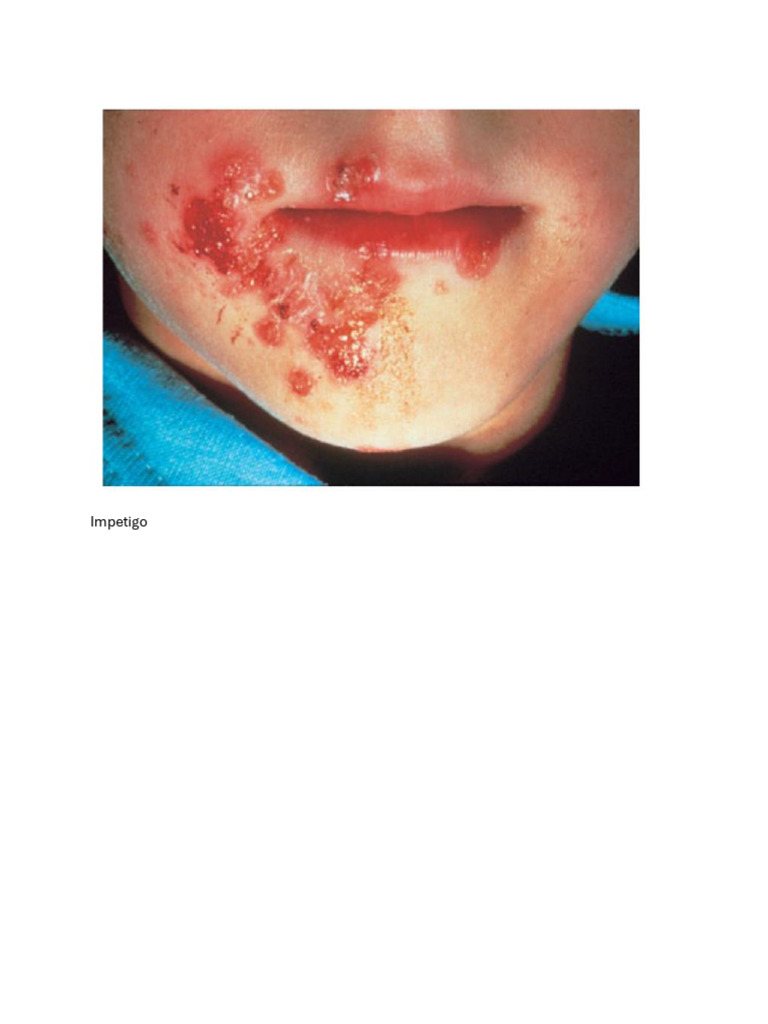 Prateek Nbme 13, 14 Pic | PDF