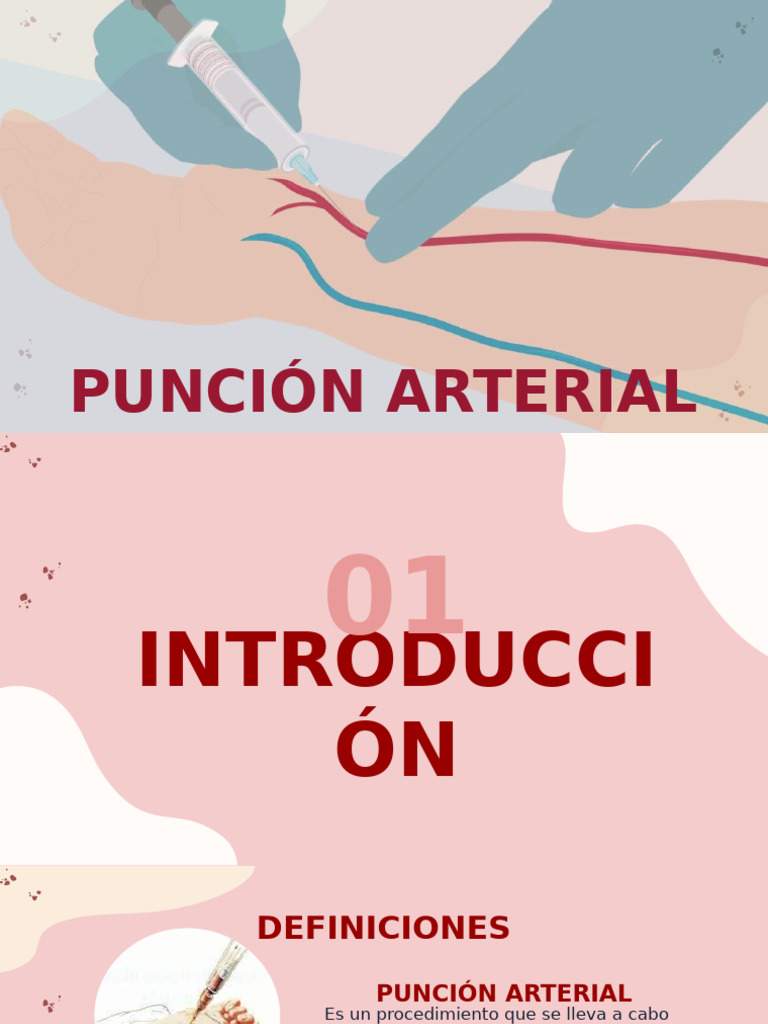 Puncion Arterial | PDF