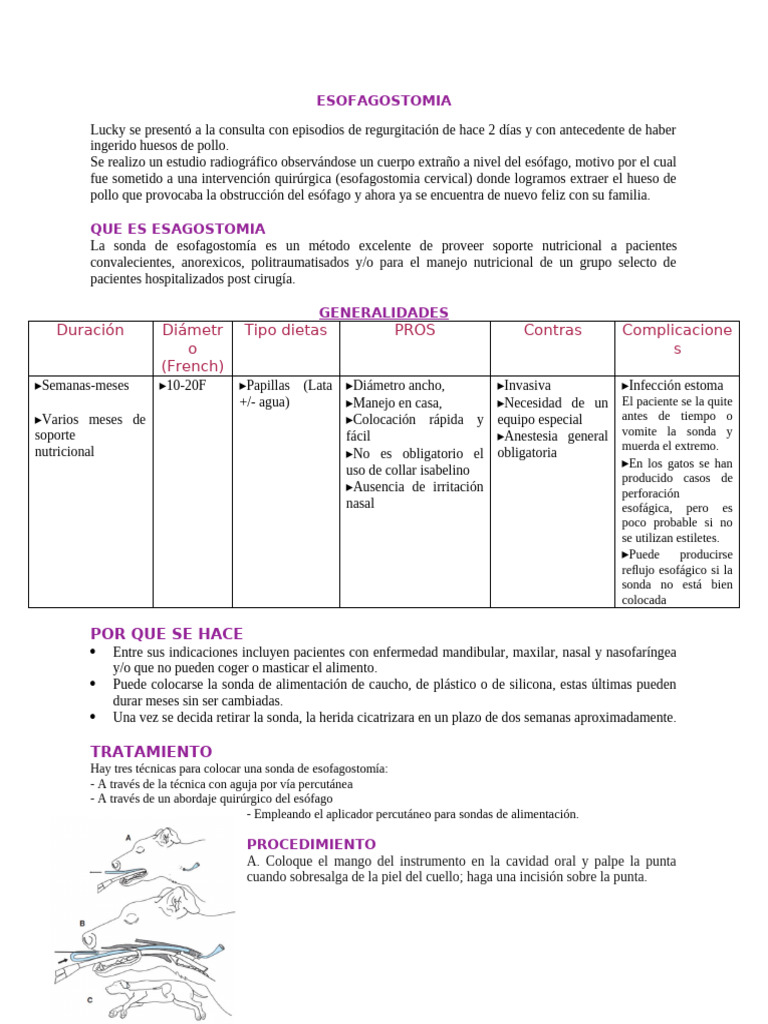 ESOFAGOSTOMIA | PDF