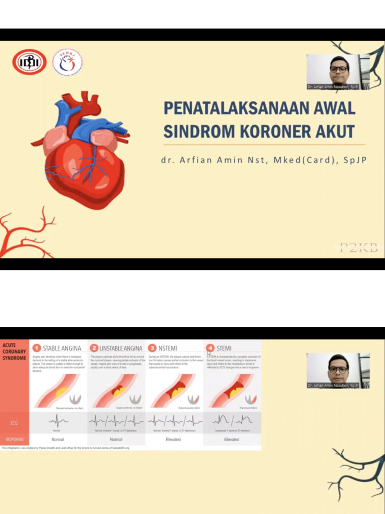 Penatalaksanaan ACS PERKI | PDF