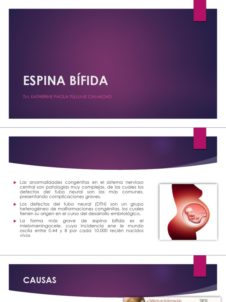 Espina Bífida | PDF