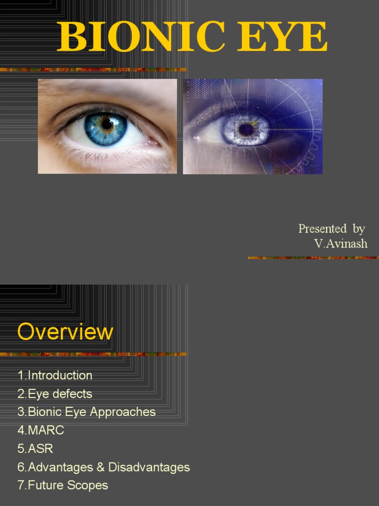 Bionic Eye | PDF | Retina | Eye