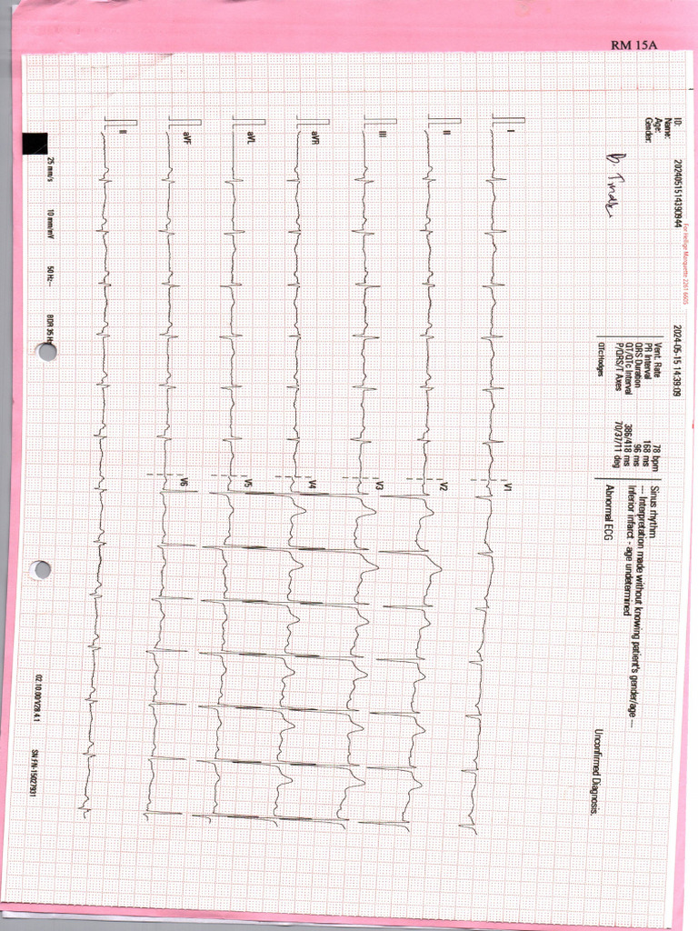 Ekg Suratno | PDF