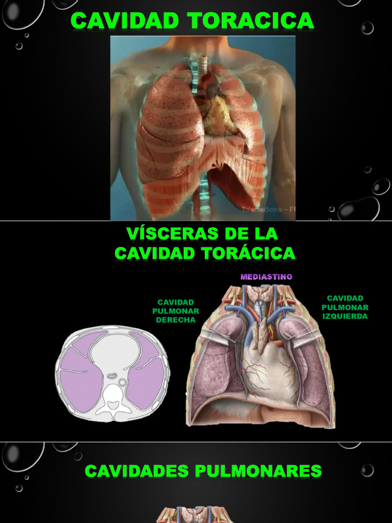 Cavidad Pleural | PDF