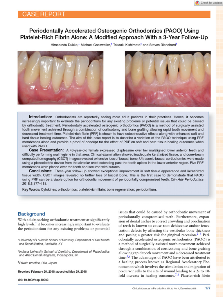 Clin Adv Periodontics - 2018 - Dukka - Periodontally Accelerated ...