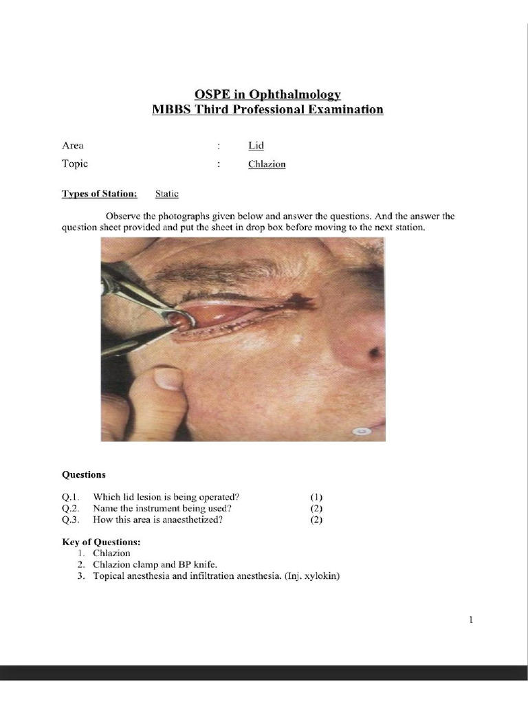 Eye OSPE Questions | PDF