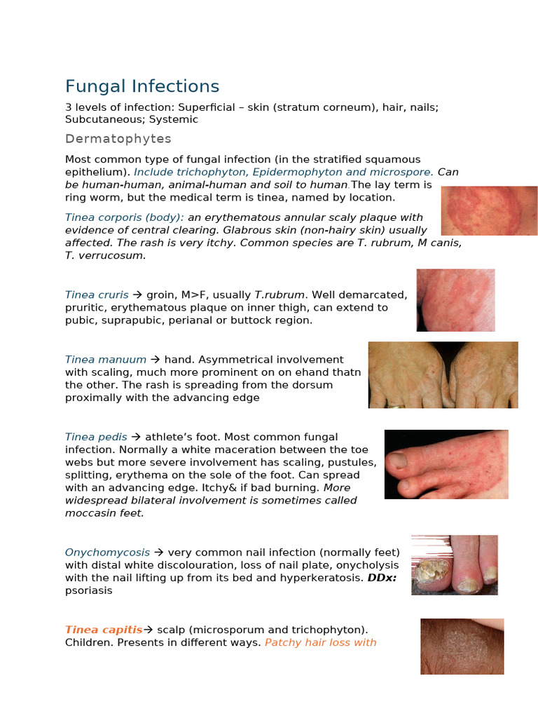 Fungal Infections | PDF