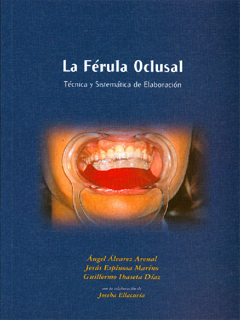 Ferula Oclusal | PDF