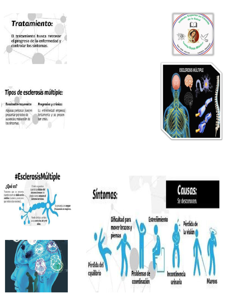 Esclerosis Multiple | PDF Esclerosis Multiple | PDF