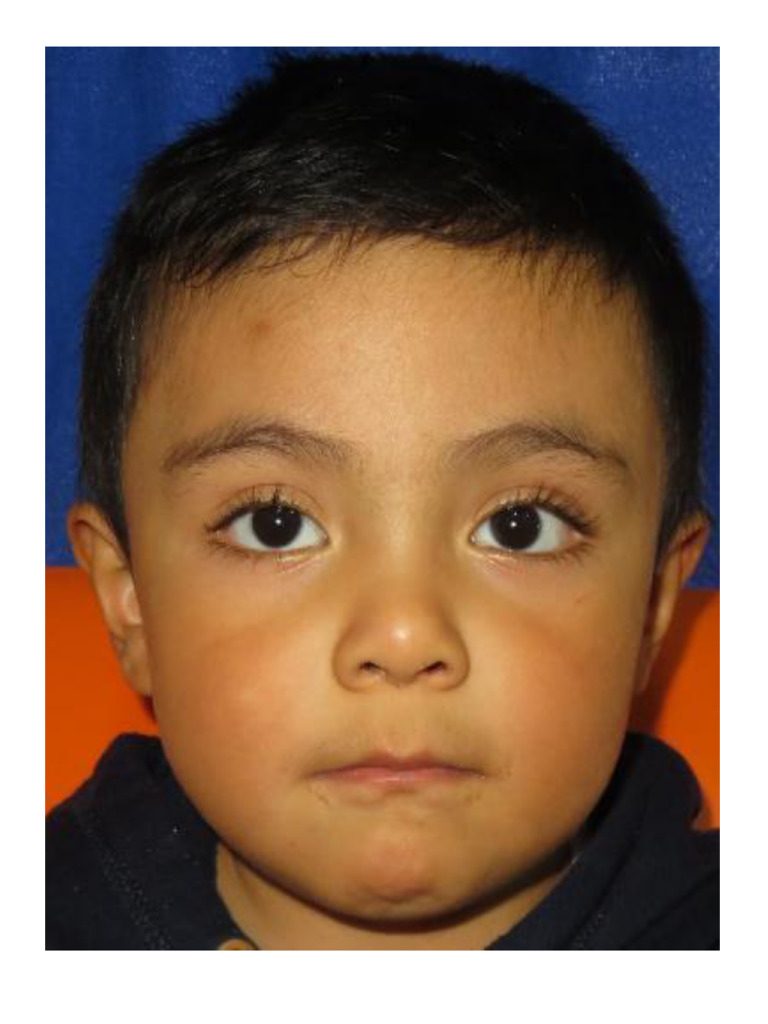 Paciente 2 masculino 3 años 6 meses | PDF