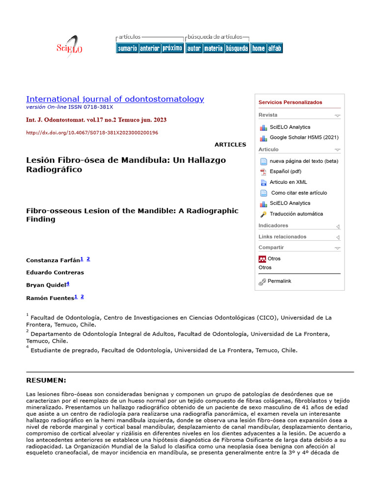 Lesión Fibro-Ósea de Mandíbula - Un Hallazgo Radiográfico | PDF