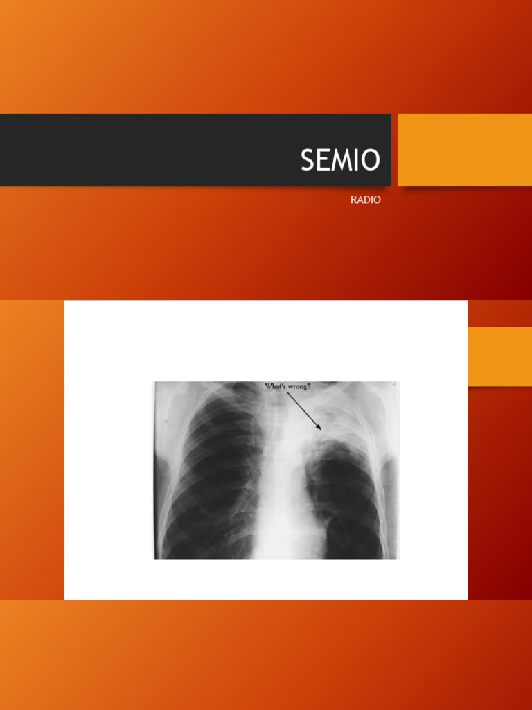 Semio Radiografii | PDF