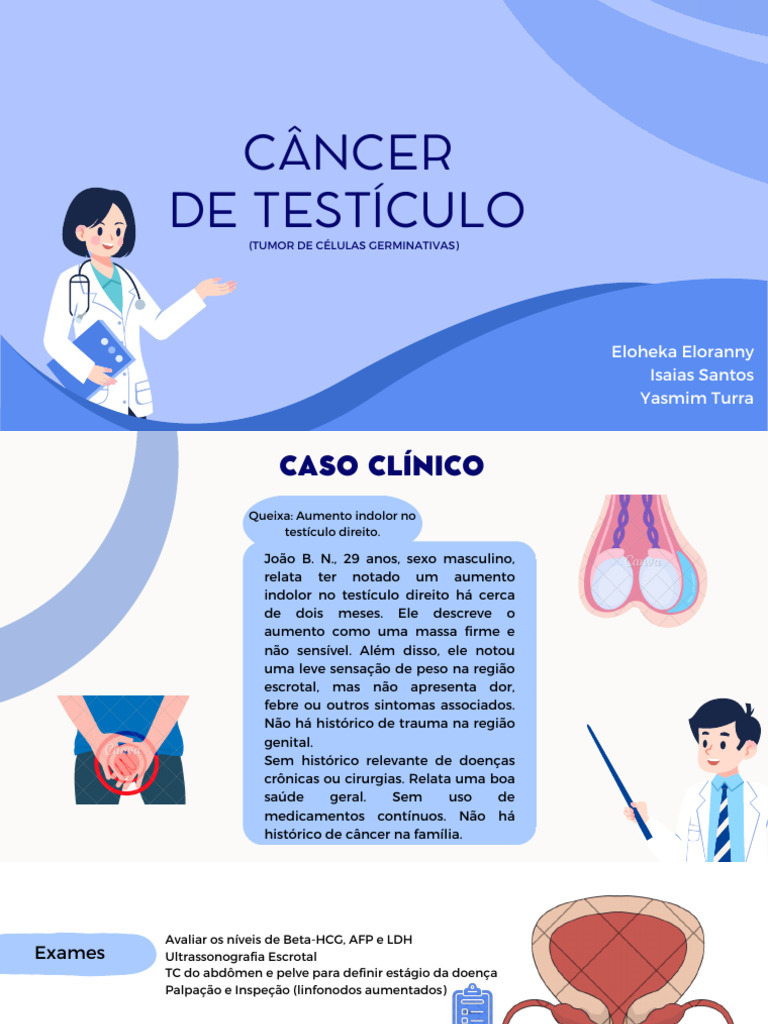 Cancer de Testiculo | PDF