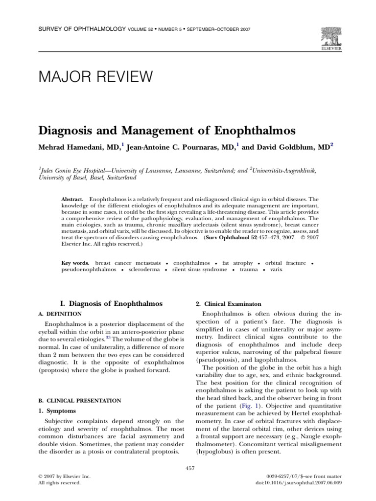 Enophthalmos Article 1795 1795 | PDF