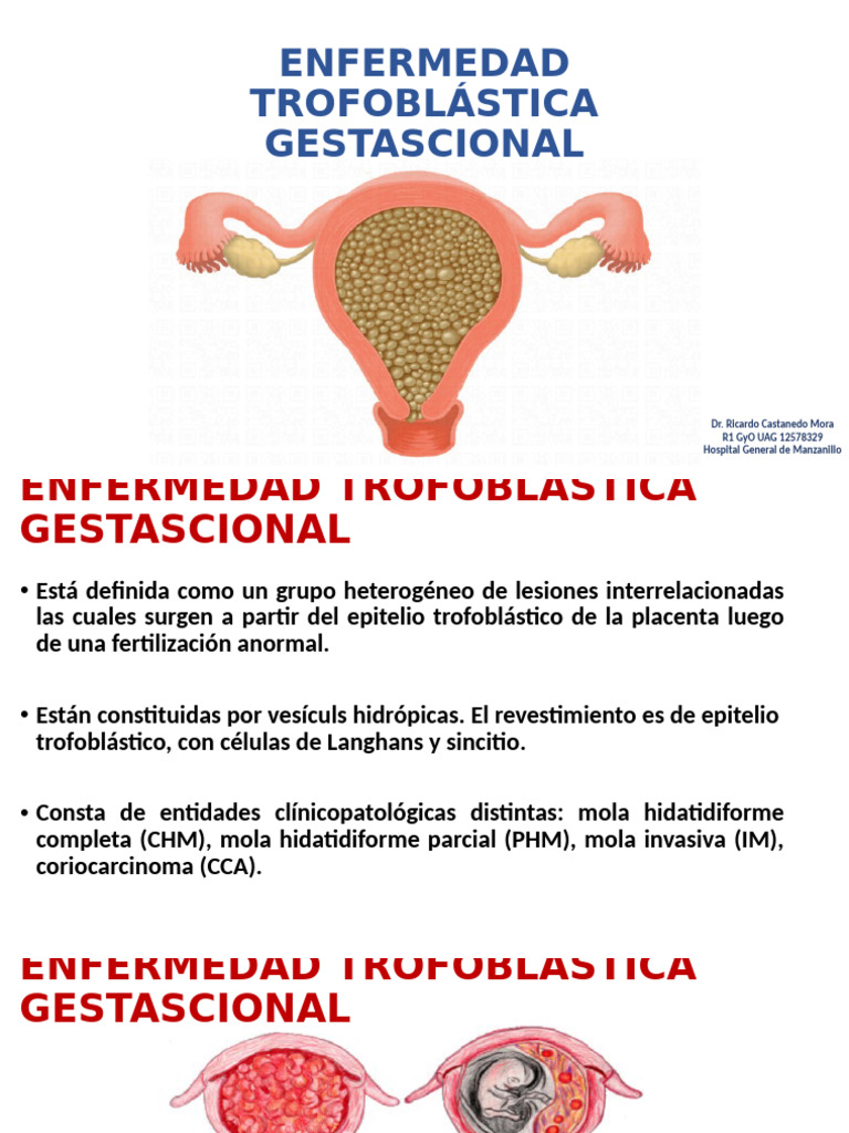 Enfermedad Trofoblástica Gestascional | PDF