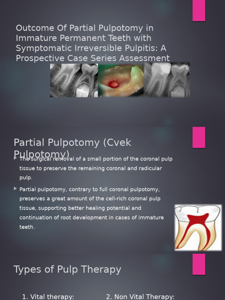 Partial Pulpotomy BDJ JOE NEW | PDF