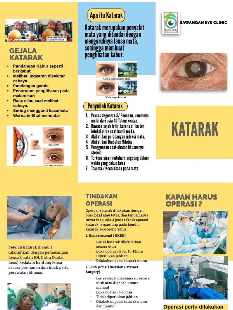 PDF Leaflet Katarak - Compress | PDF