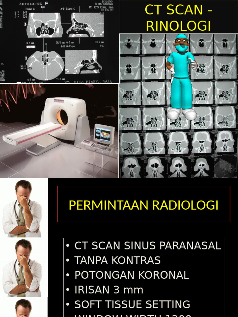 Ctscan SPN | PDF