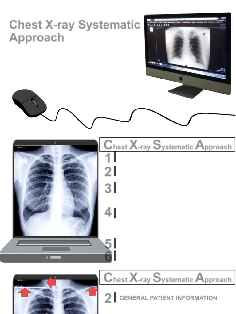 4. PPT Chest X-Ray Interpret | PDF