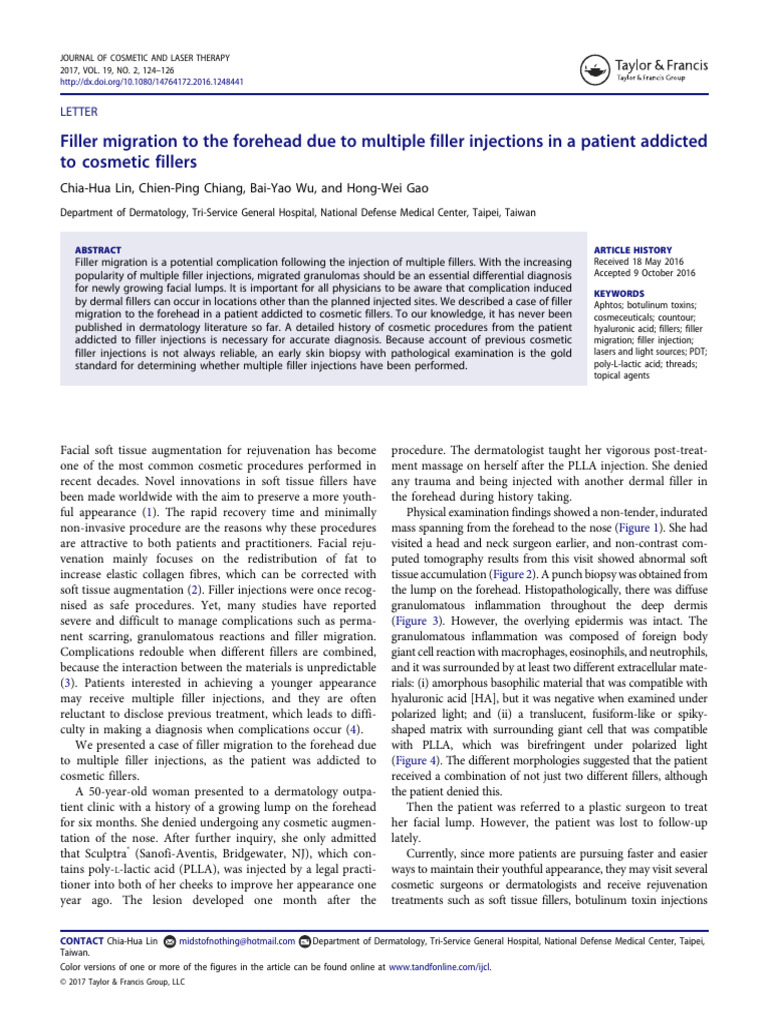 Filler Migration To Forehead | PDF | Dermatology | Clinical Medicine