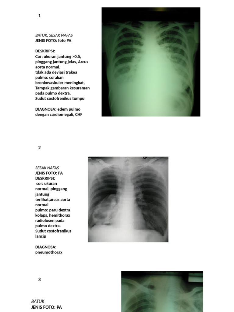 Pembahasan soal radiologi kepala, thorax, abdomen, ekstremitas | PDF