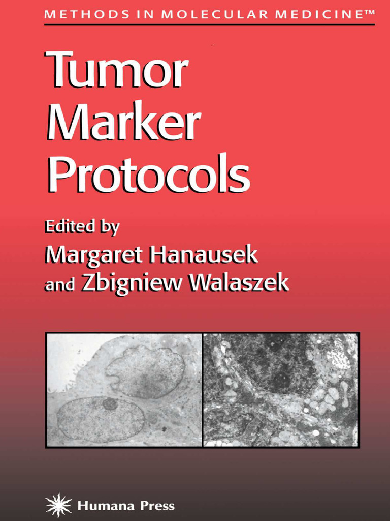 Tumor Marker Protocol | PDF