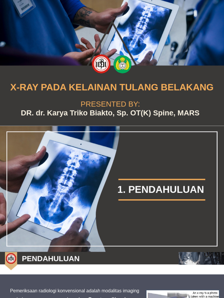 Ppt X Ray Spinal Disorders 1 Pdf