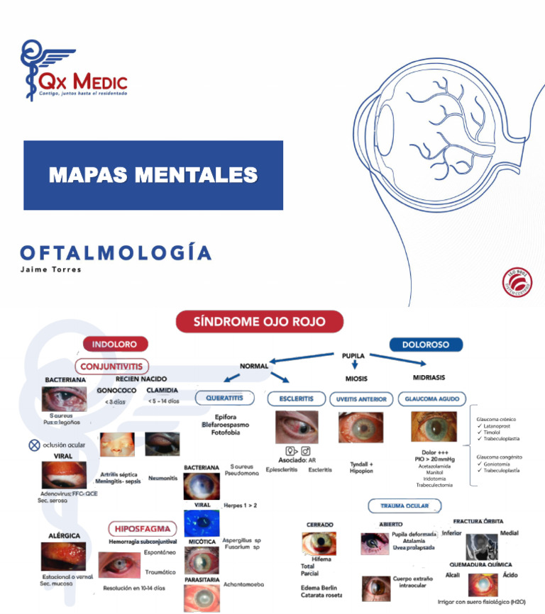 Mapa Mental - Oftalmología | PDF