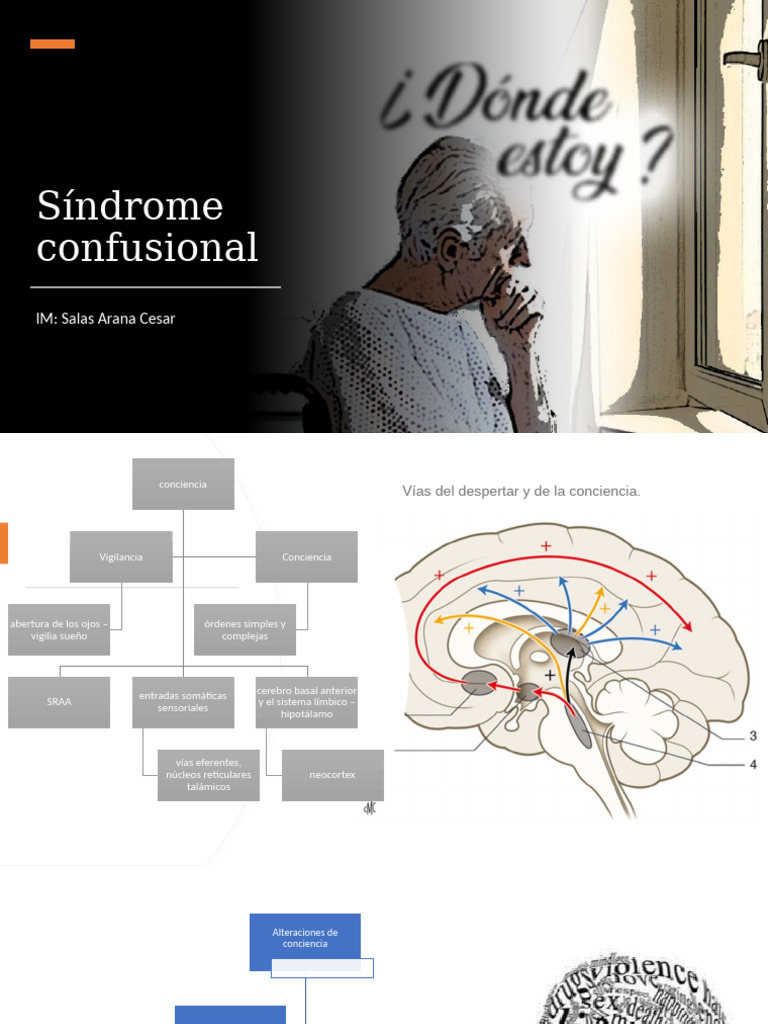 Síndrome Confusional | PDF