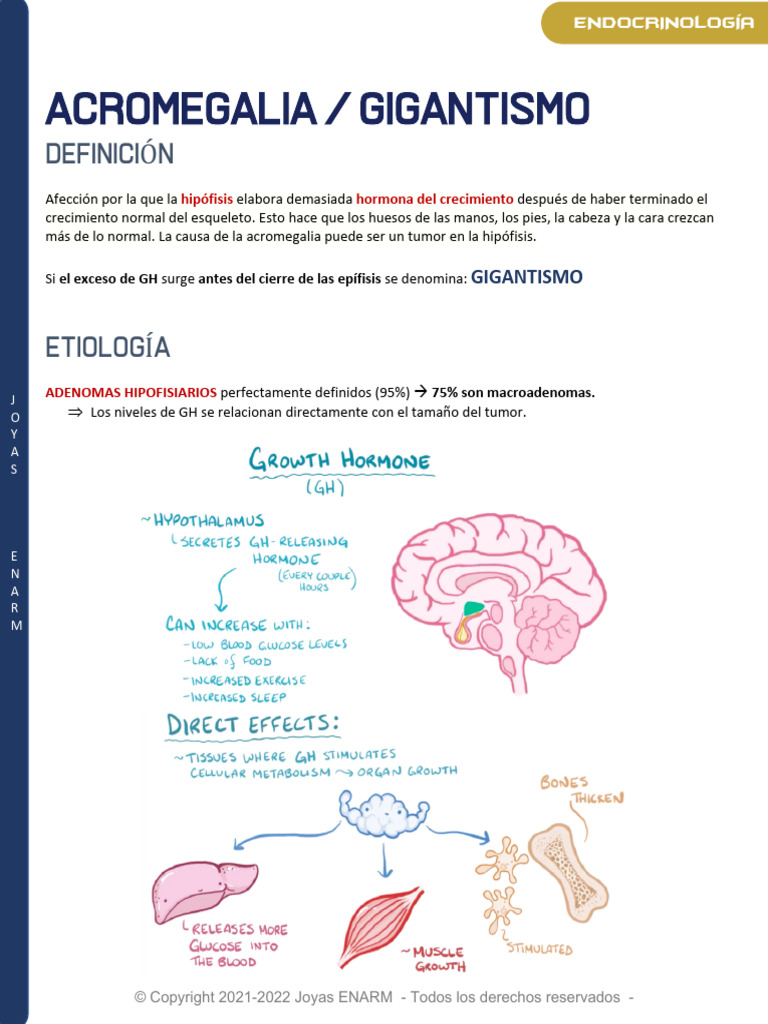 Acromegalia - Gigantismo | PDF