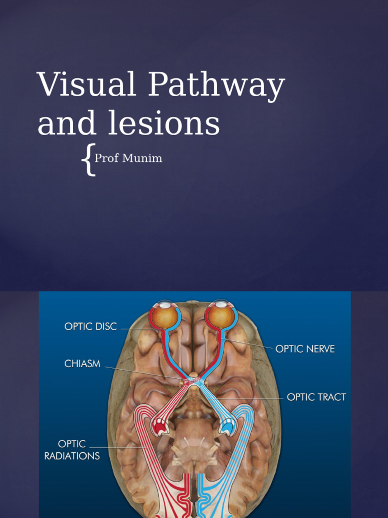 Visual Pathways and Their Lesions | PDF