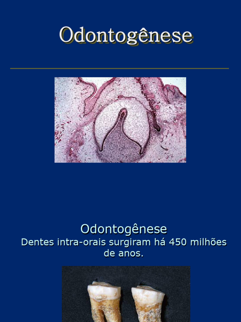 Odontogênese. | PDF