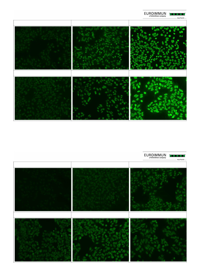 Intensity of ANA Pattern - EUROIMMUN | PDF