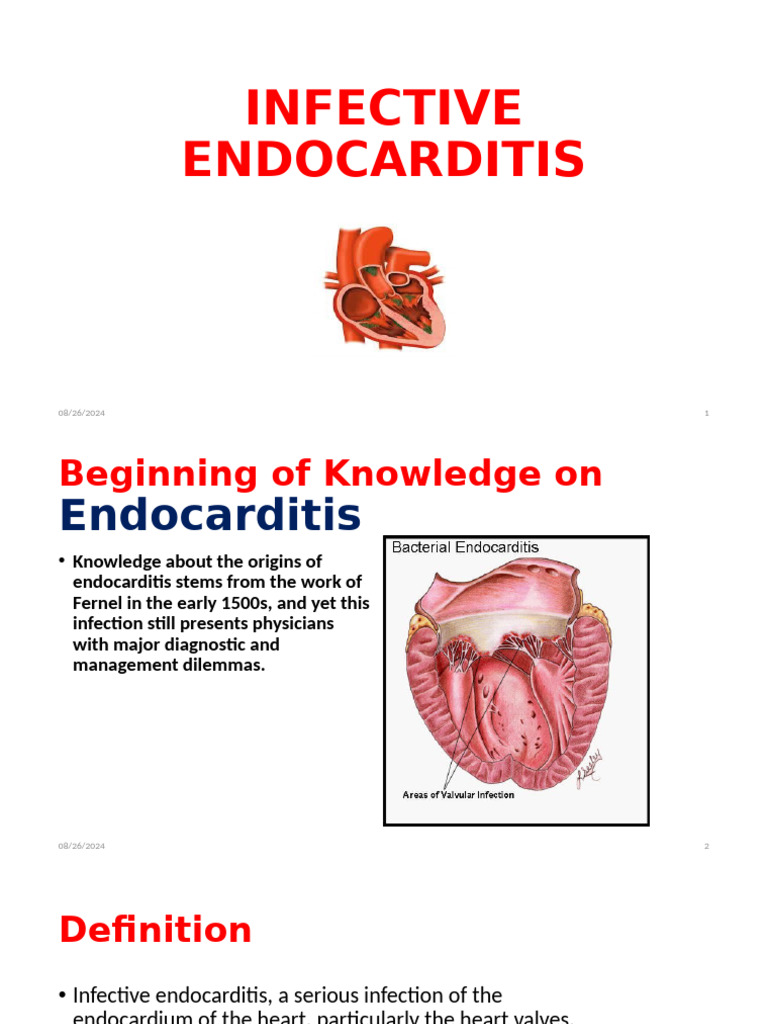 Infective Endocarditis | PDF