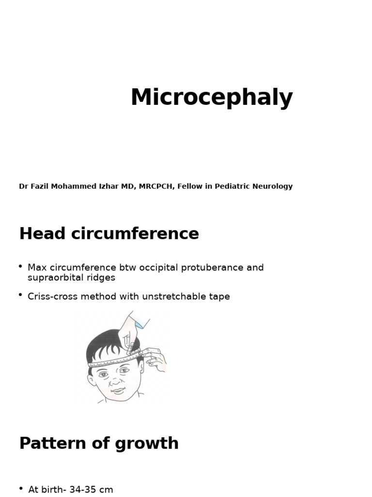 Microcephaly | PDF