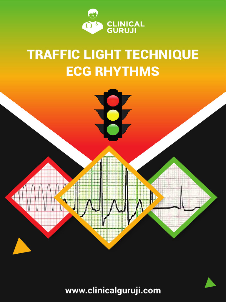 Traffic Light Technique For Ecg Rhythm | PDF