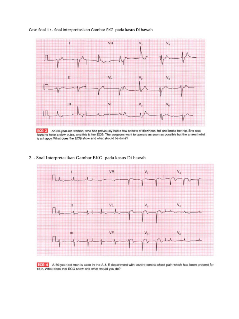 Soal 12 Lead Ekg 2024 | PDF | Science & Mathematics