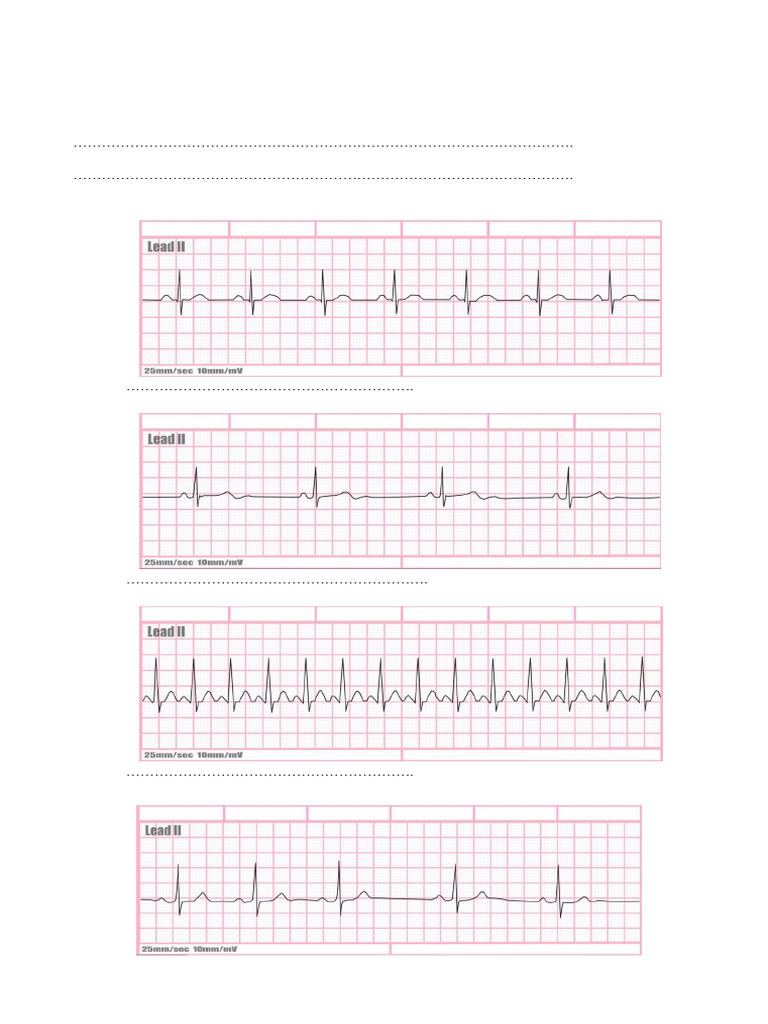 Latihan Baca EKG | PDF