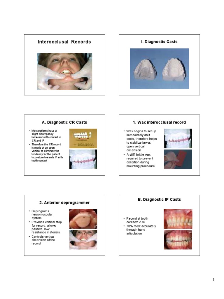 Interocclusal Records: I. Diagnostic Casts | PDF | Dentures | Dentistry ...