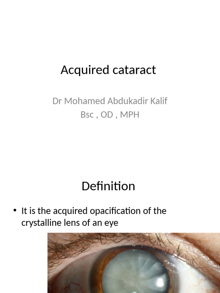 Acquired Cataract | PDF