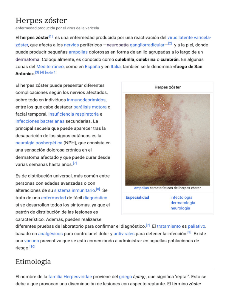 Herpes Zóster | PDF