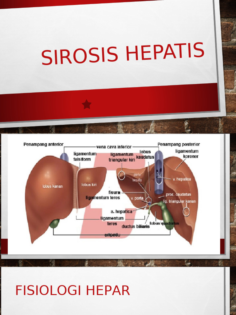 Sirosis Hepatis | PDF