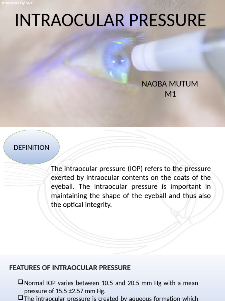 Intraocular Pressure: Naoba Mutum M1 | PDF