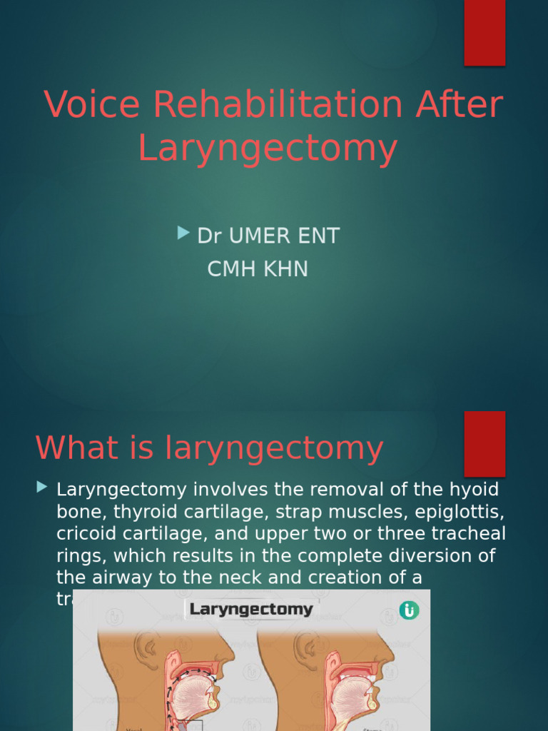 Voice Rehablitation After Laryngectomy | PDF